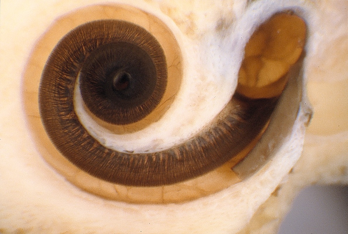 Pictures Of The Ear Deep In The Cochlea The MED EL Blog