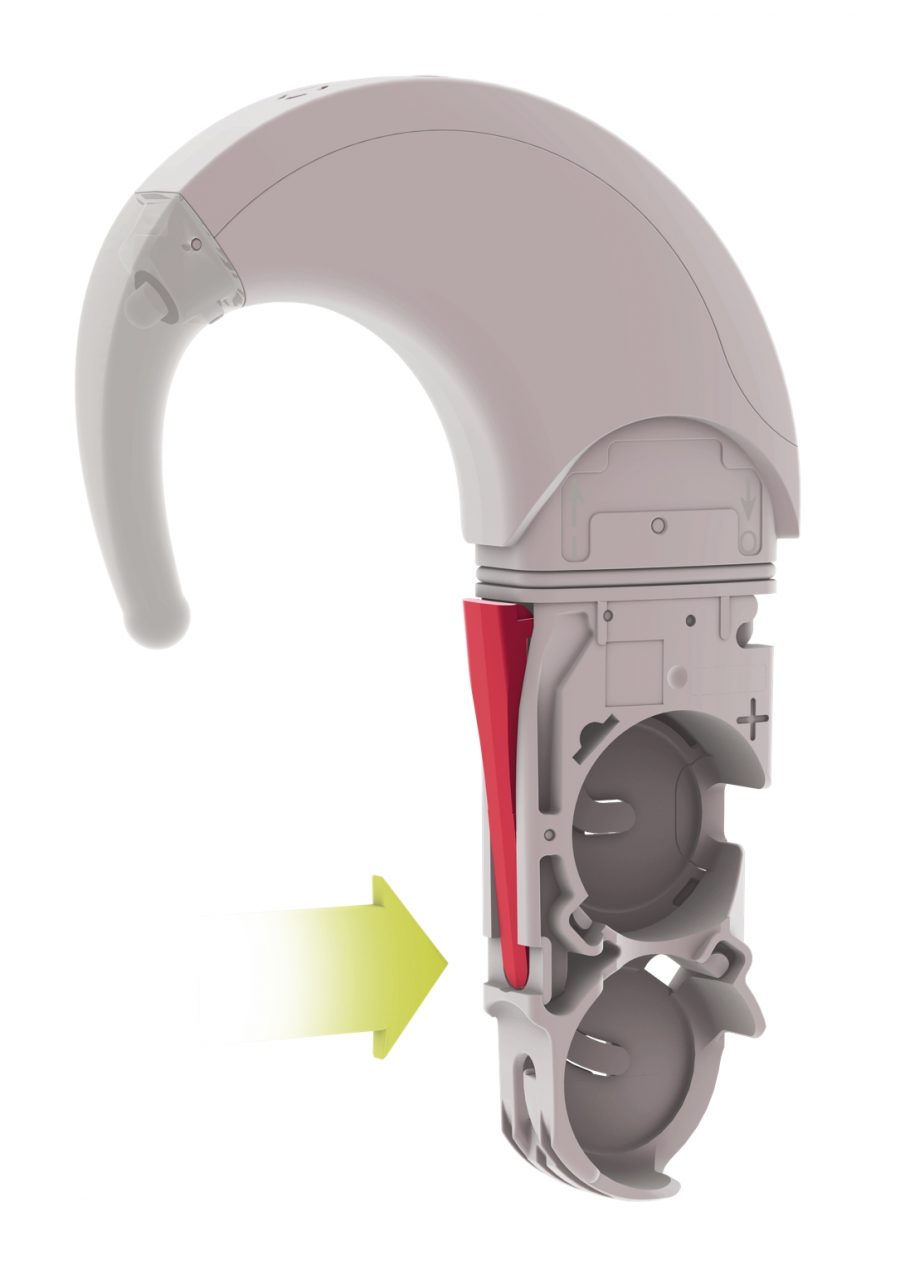 Hands-On: SONNET Rechargeable Batteries - MED-EL Professionals Blog