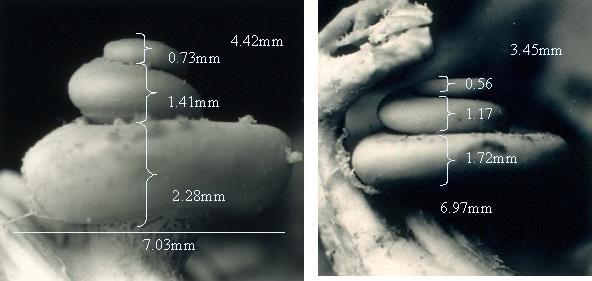 Incredible Synchrotron Imaging: New Findings in the Human Cochlea ...